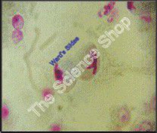 Grasshopper Testis (sect) - Meiosis & Mitosis - Prepared Microscope ...
