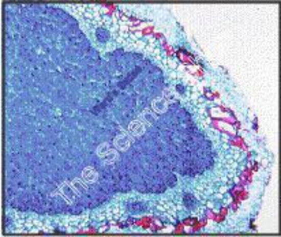 Root Nodules, Legume Bacteria Slide - Roots - Prepared Microscope ...