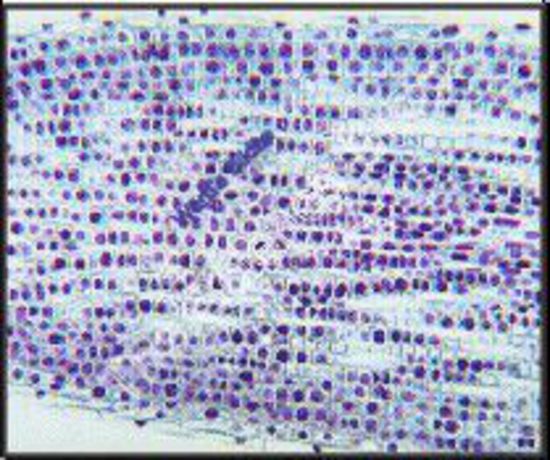 Onion Alium Root tip Mitosis (ls) Showinq all stages (ls) F - Meiosis ...