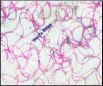 Nostoc (wm) Filament and heterocysts with occasional spores within ...