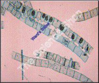 Spirogyra (wm) Scalariform conjugation - Protists - Prepared Microscope ...
