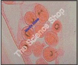 Echinococcus granulosus Hydatid Cyst sect Relationship of brood capsule ...