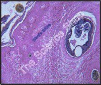 Sarcoptes Scabiei (wm) in situ - Zoology - Prepared Microscope Slides ...